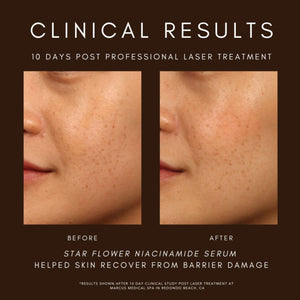 Star Flower Niacinamide Serum – SAINT JANE